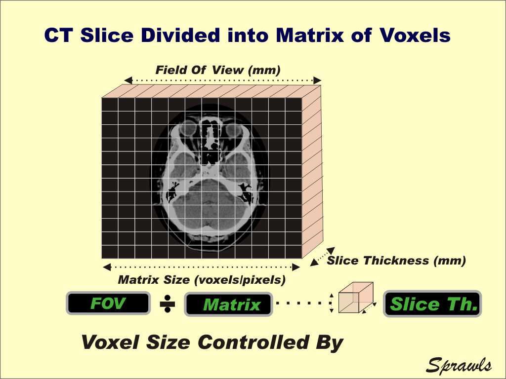 CT Image Quality Optimization And Dose Management CT Image Quality Optimization And Dose Management