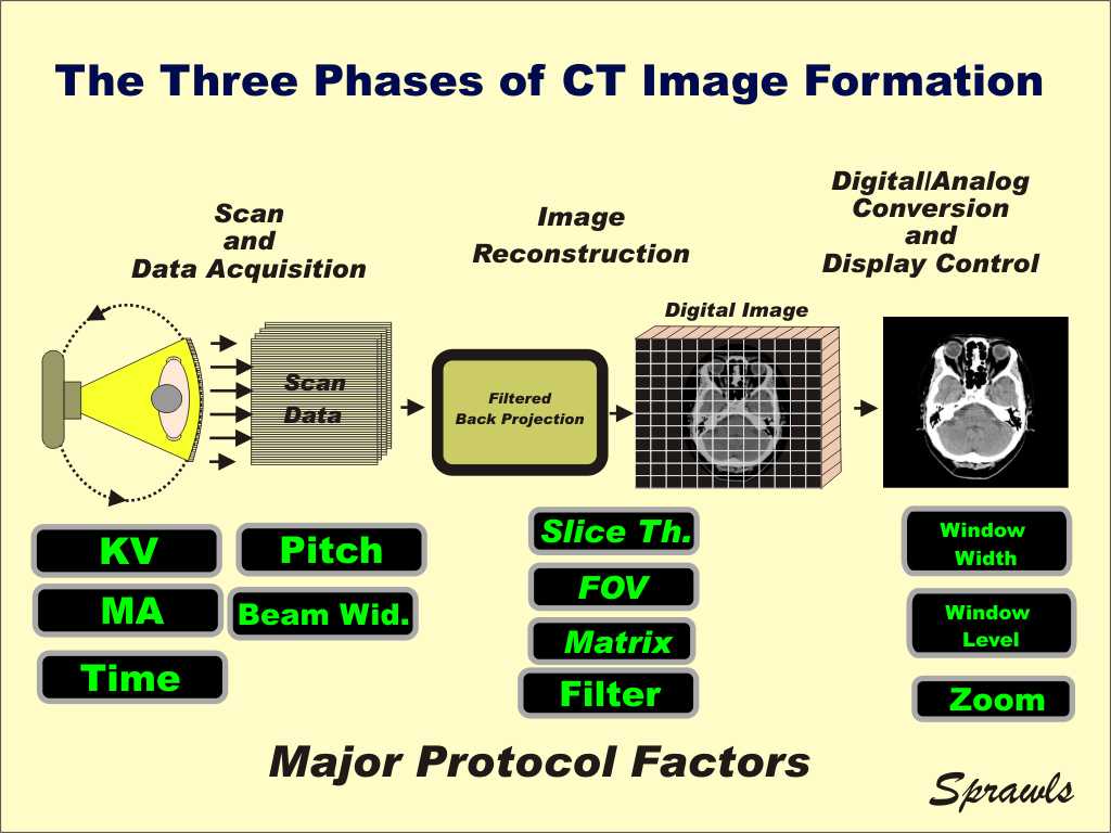 CT Image Quality Optimization And Dose Management CT Image Quality Optimization And Dose Management